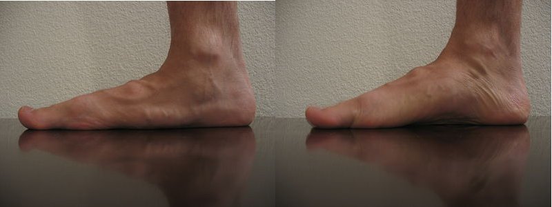 short foot – Barefoot Strong Blog